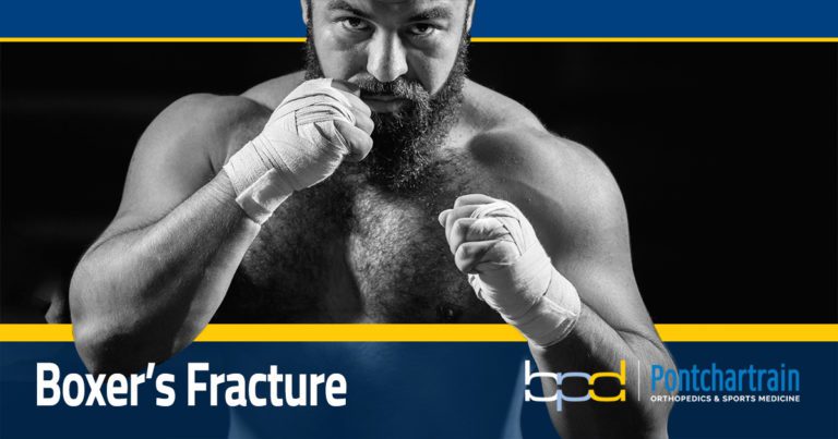 Boxer's Fracture - Hand Specialist Brandon P. Donnelly, MD