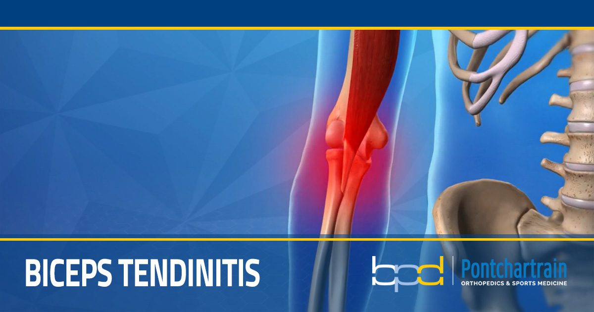 Biceps Tendinitis - Brandon P. Donnelly, MD