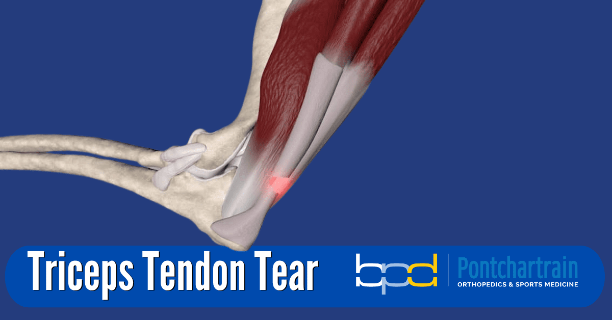 Triceps Tendon Tear - Brandon P. Donnelly, MD
